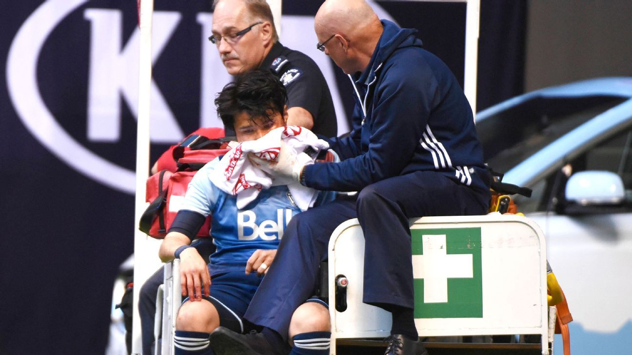 Vancouver Whitecaps' Masato Kudo has fractured jaw, will have surgery ...
