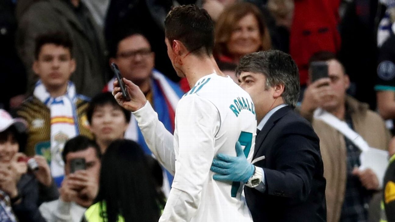 Cristiano Ronaldo uses phone to check head wound in Real's win vs ...